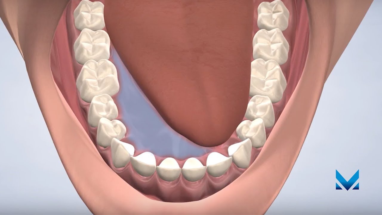 Oral Pathology in Flint MI | Greater Michigan Oral Surgeons & Dental ...