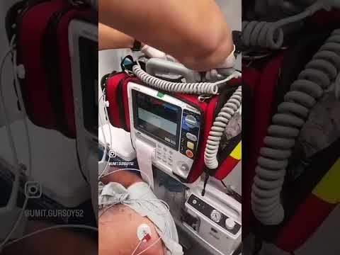 Anstabil Ventriküler Taşikardide Kardiyoversiyon Uygulaması