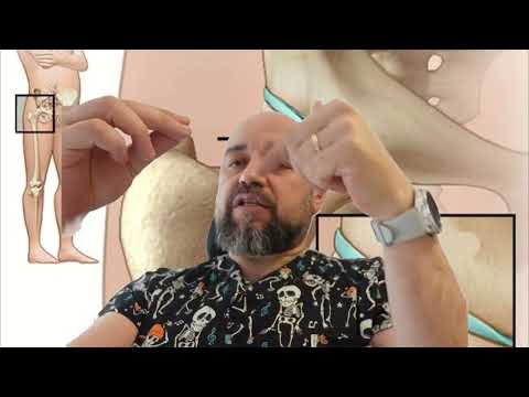 KAlça LAbrum Yırtıkları (Op. Dr. Barış Özgürol)