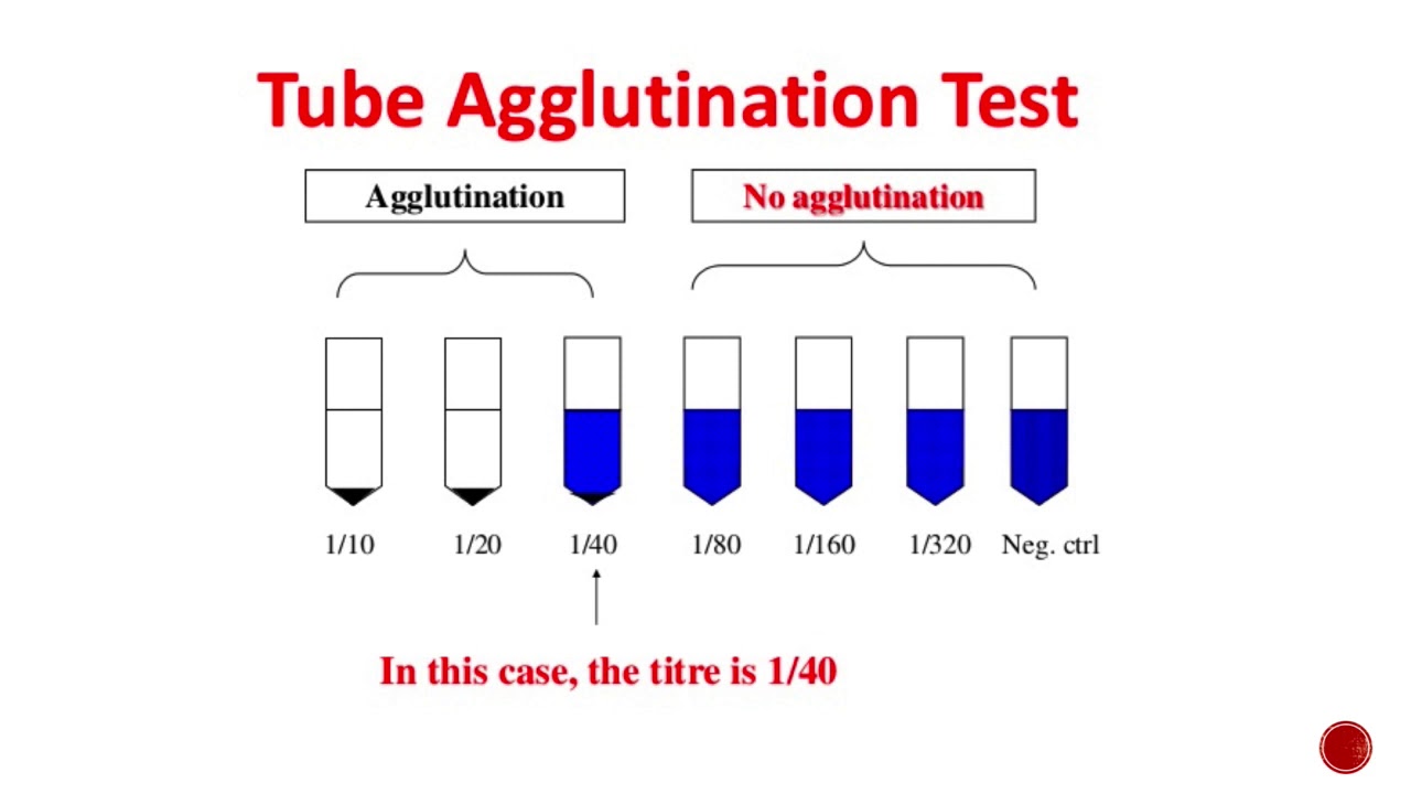 AG AB reaction Part 2 - YouTube
