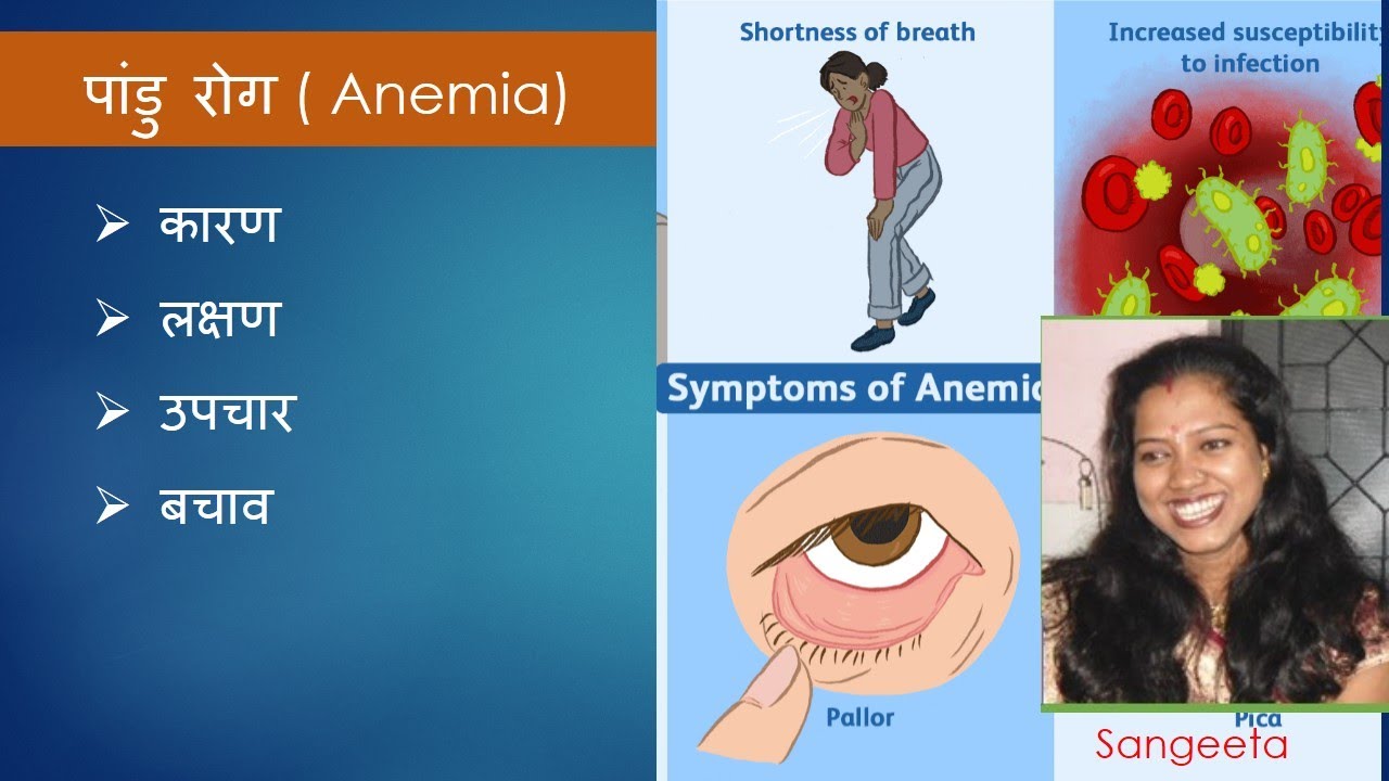Anemia or pandu rog ! causes ! Symptoms ! teatment ! sangeeta - YouTube
