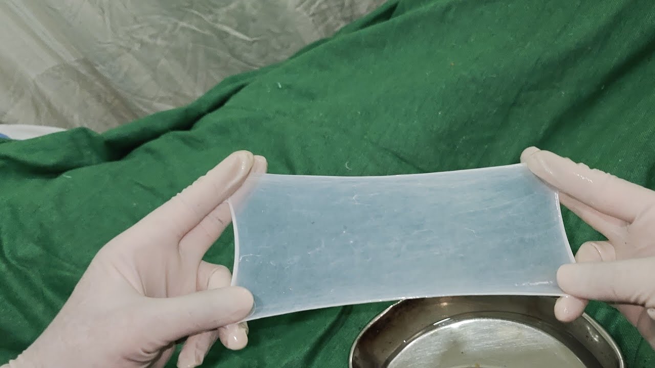 Face Burn Collagen Dressing | कोलेजन ड्रेसिंग का उपयोग | LPG BLAST ...