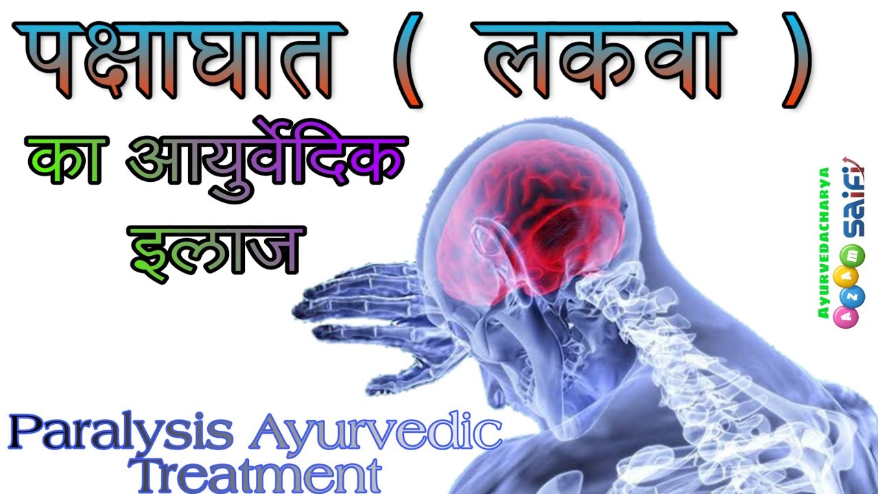 पक्षाघात (लकवा) का आयुर्वेदिक इलाज || Ayurvedic Treatment of Paralysis ...