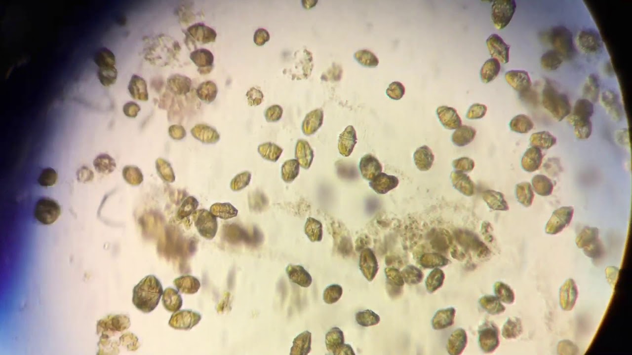 Gymnodinium catenatum - YouTube