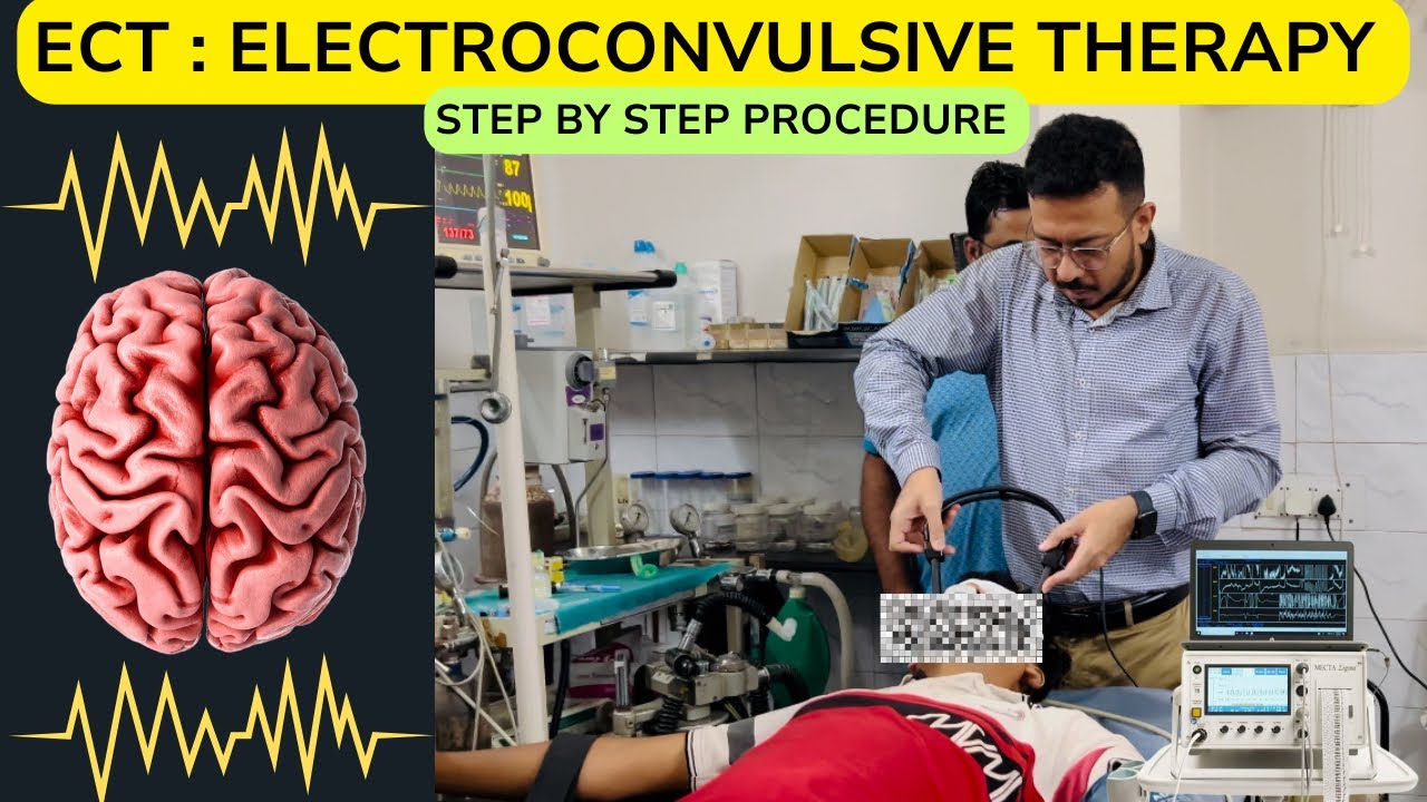 ECT : Electroconvulsive Therapy Real Video। मानसिक बीमारियों के लिए ...