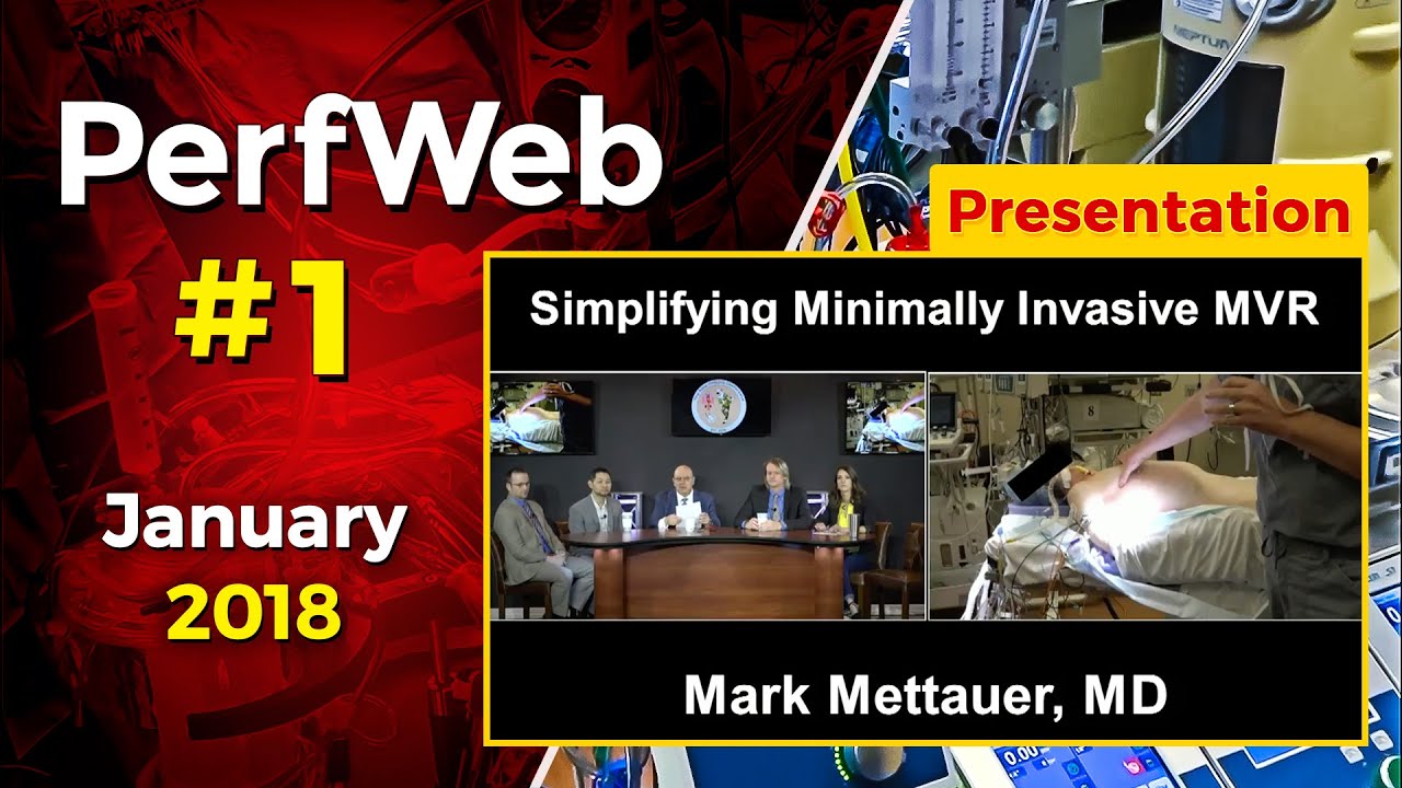 Simplifying Minimally Invasive MVR - Minimally Invasive Mitral Valve ...