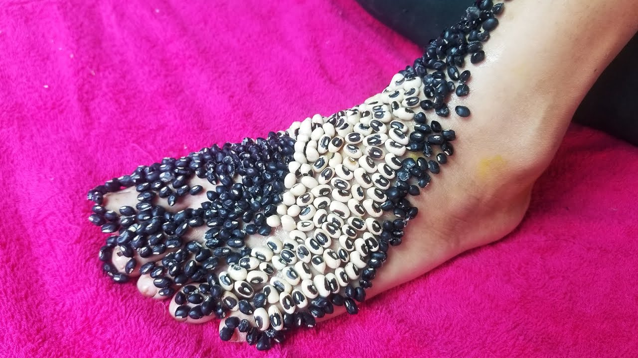 Remove strange ticks on feet - YouTube