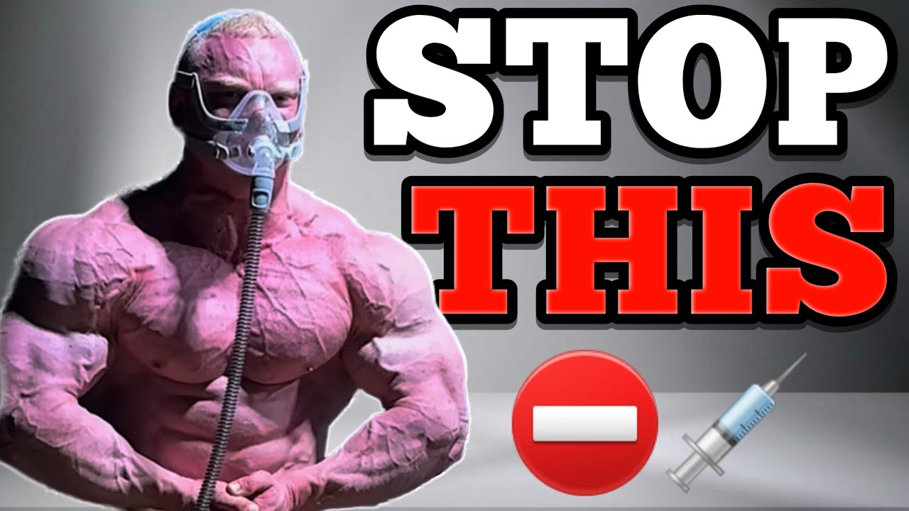 Steroids DESTROYED His Life | Max Wadsworth - YouTube