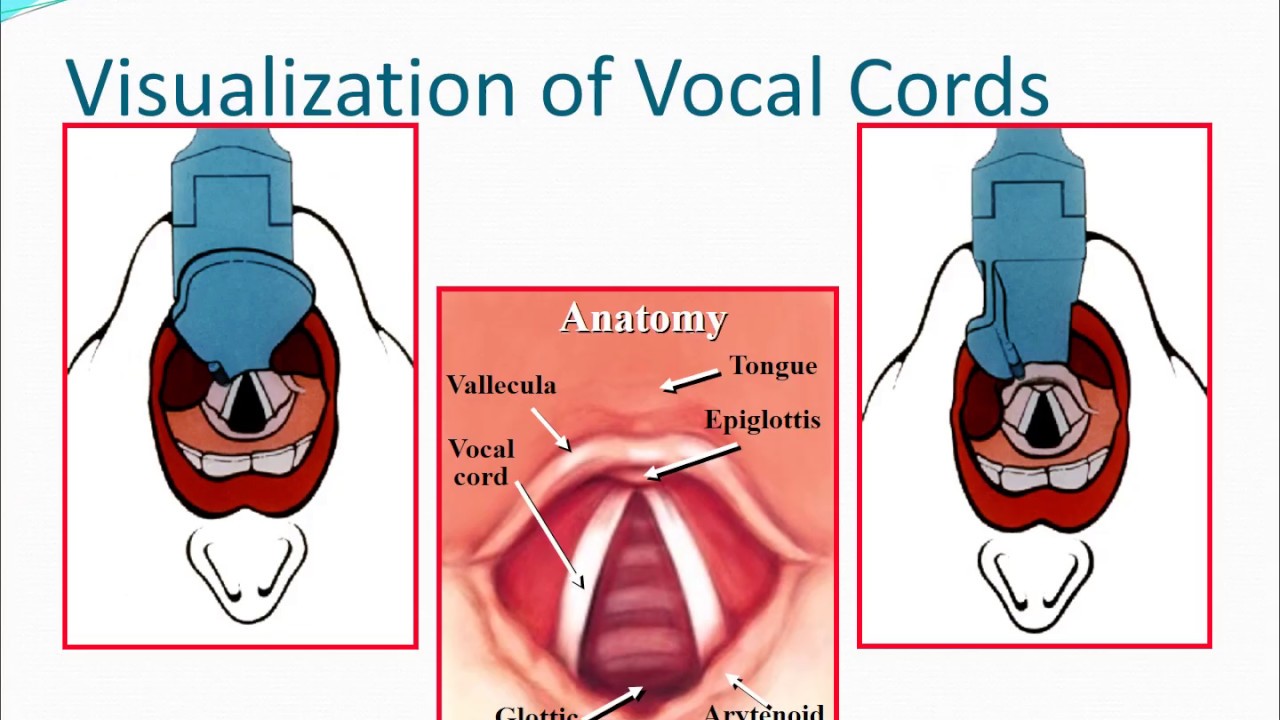 Airway Management | Surgical Critical Care Workshop at Bahria ...