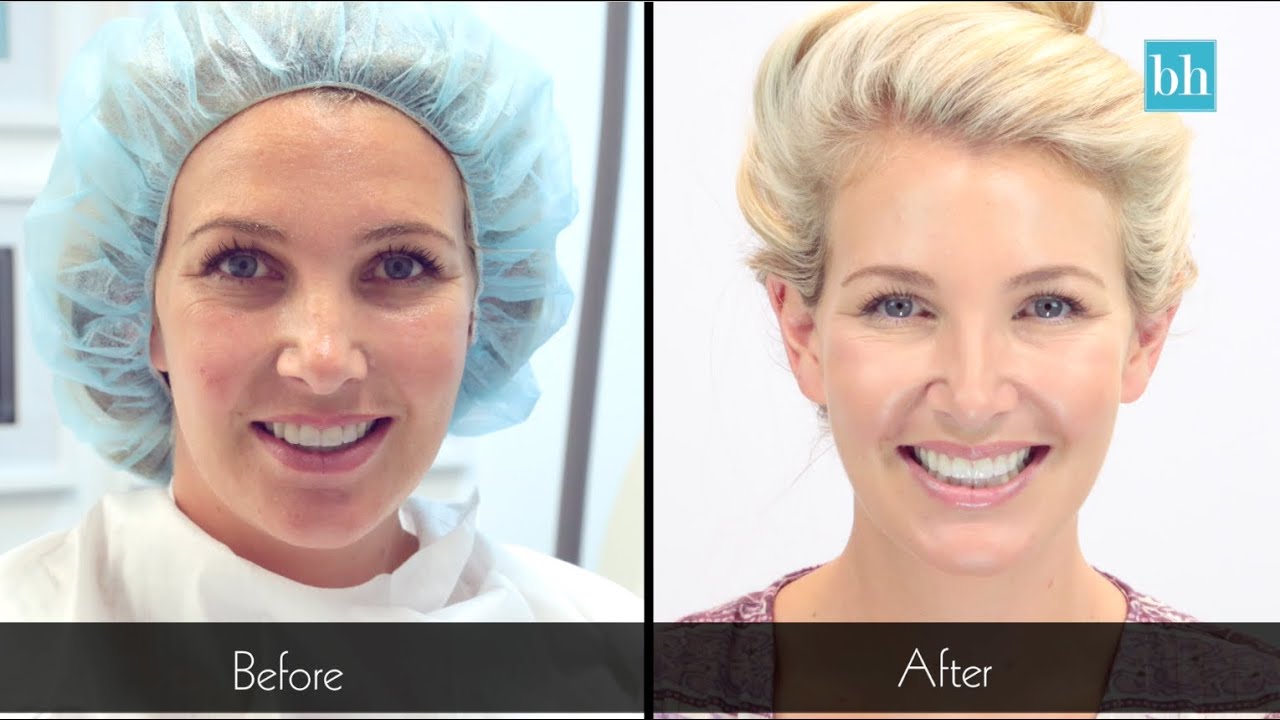 What is Fraxel? - YouTube