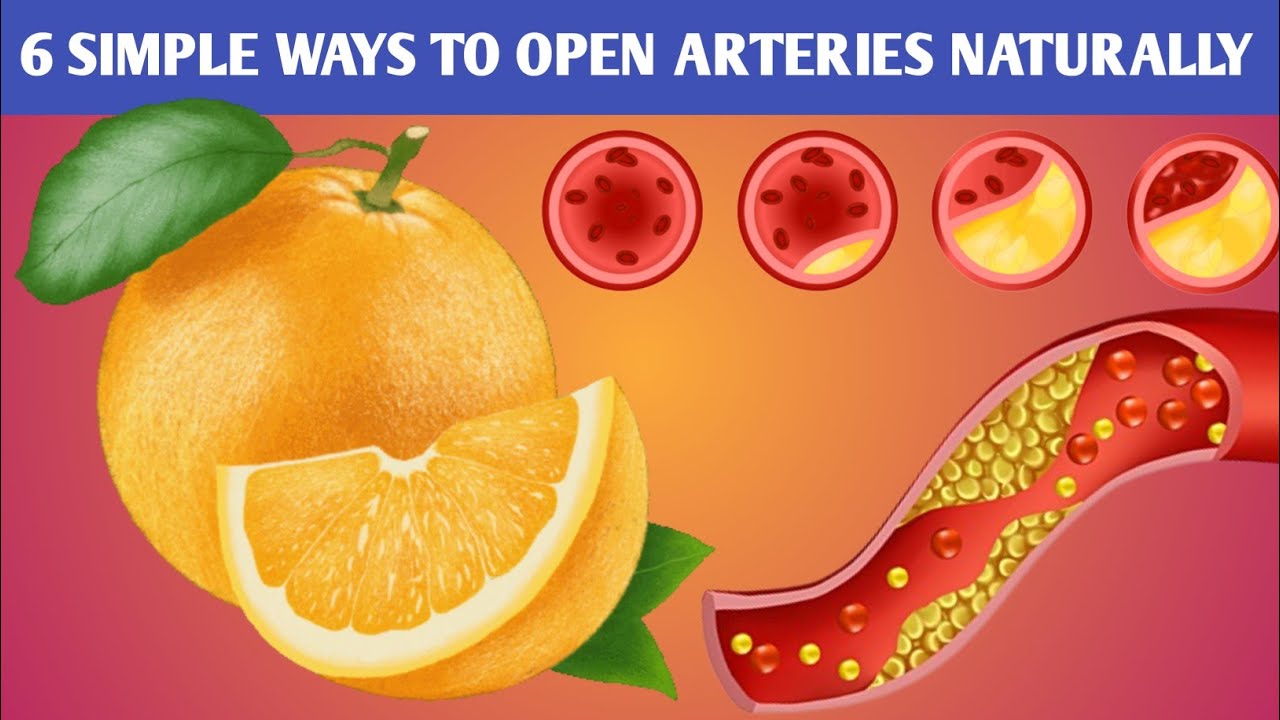 Best Ways To Open Arteries Naturally | Artery Blockage Removal ...