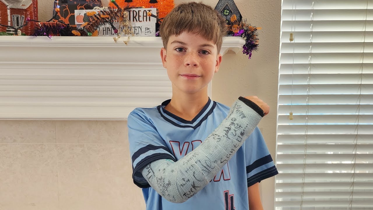 Cast Troubles - I Am Not Left-Handed - YouTube