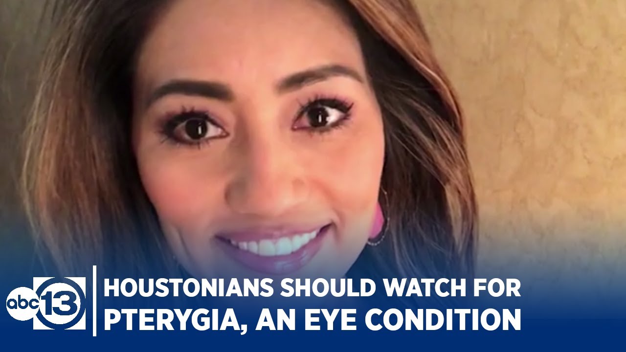 Why Houstonians should watch for Pterygia, an eye condition - YouTube