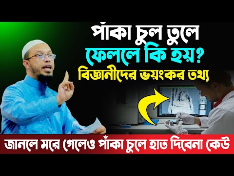 পাকা চুল তুলে ফেললে কি হয় জানলে অবাক হবেন।  শায়খ আহমাদুল্লাহ sheikh ahmadullah