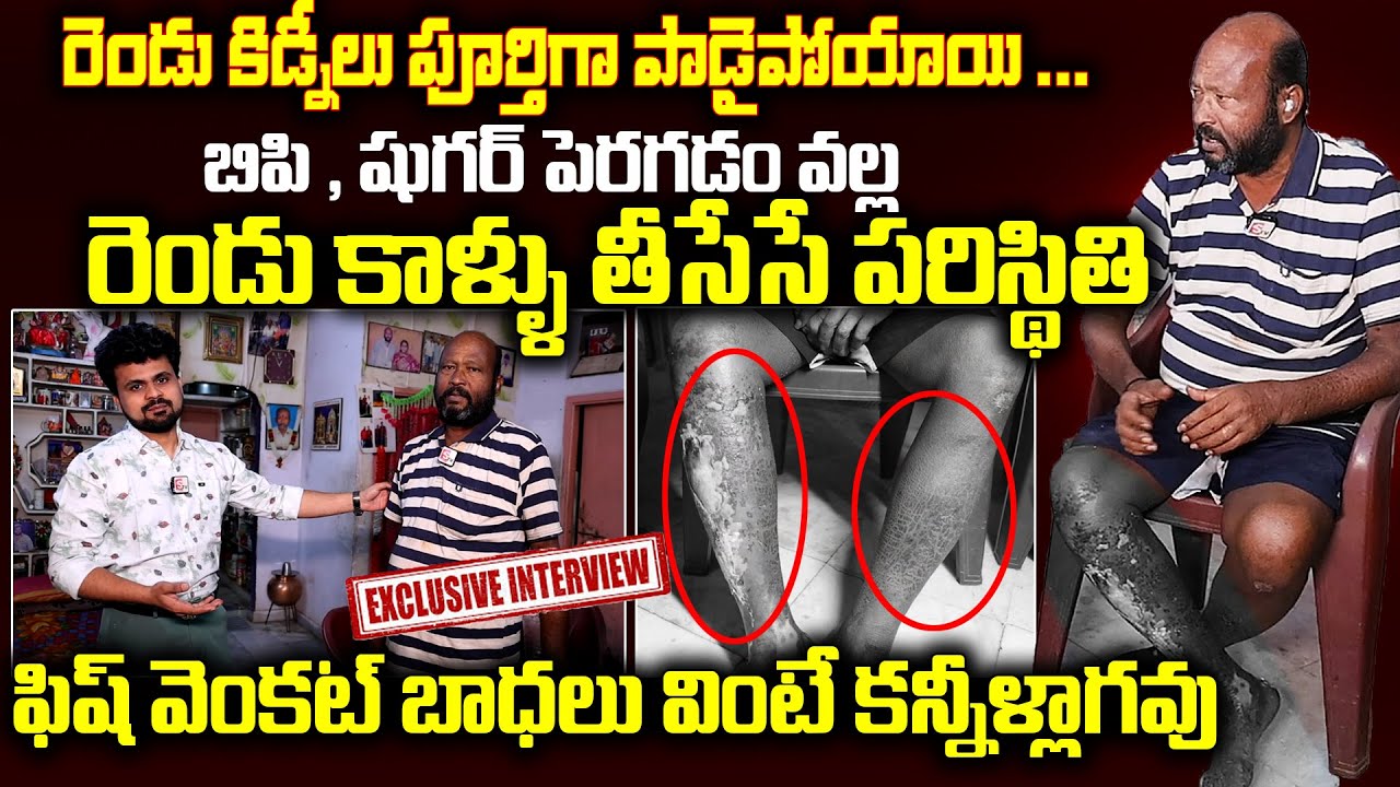 Actor Fish Venkat Exclusive Interview With Anchor Roshan | Telugu ...