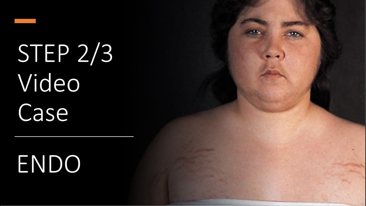 ENDO STEP 2 Case + Explanation (Case 5) - YouTube