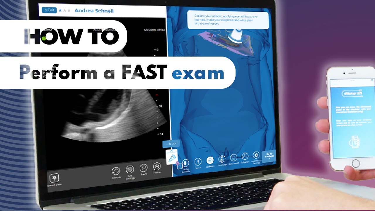 #howto perform a FAST exam in diSplay U/S simulator - YouTube