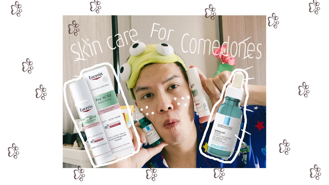 รักษาสิวอุดตัน by eucerin post acne marks reduction + la roche posay ...