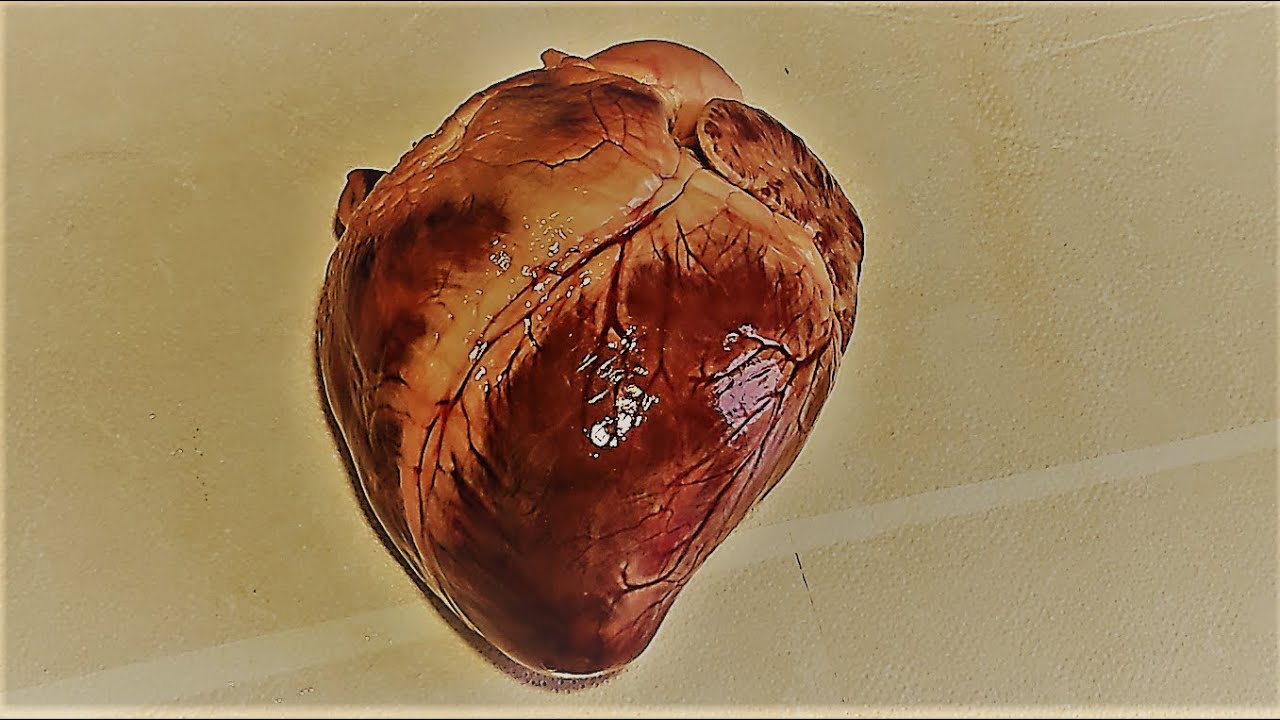 Disección corazón - YouTube
