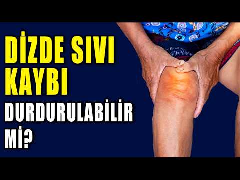 Dizde Sıvı Kaybı Neden Olur? Yapılan Hatalar ve 3 Egzersiz