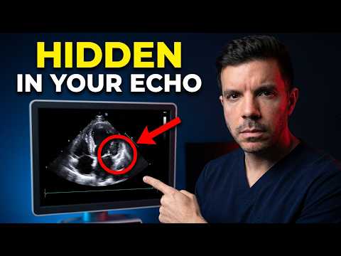 Your Echocardiogram Results: 5 Things Your Doctor Might Not Tell You