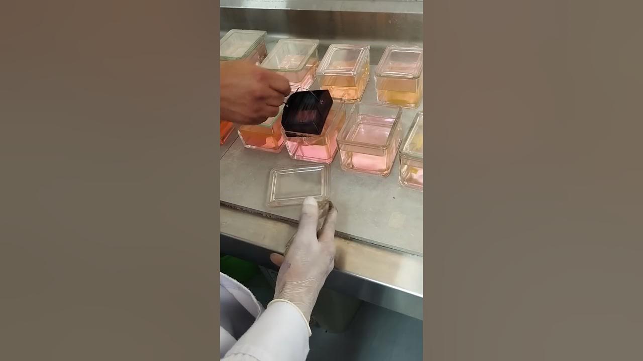 Coloración de Verhoeff - Parte 7 - YouTube