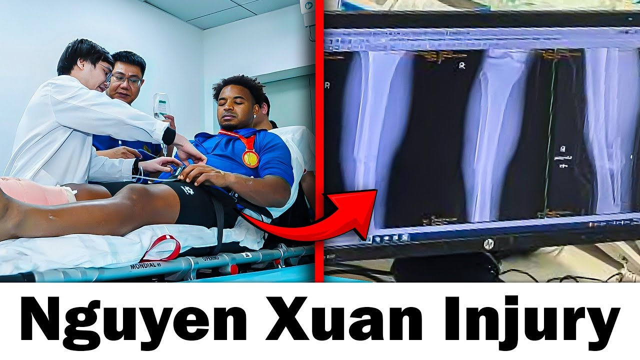 Nguyen Xuan Son Injury Update: Cidera Parah di Final AFF 2024 vs ...