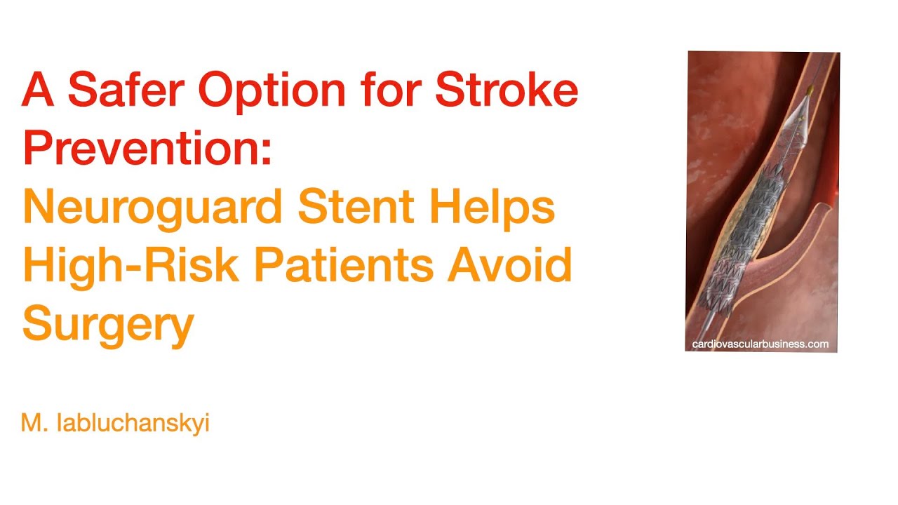 A Safer Option for Stroke Prevention: Neuroguard Stent Helps High-Risk ...