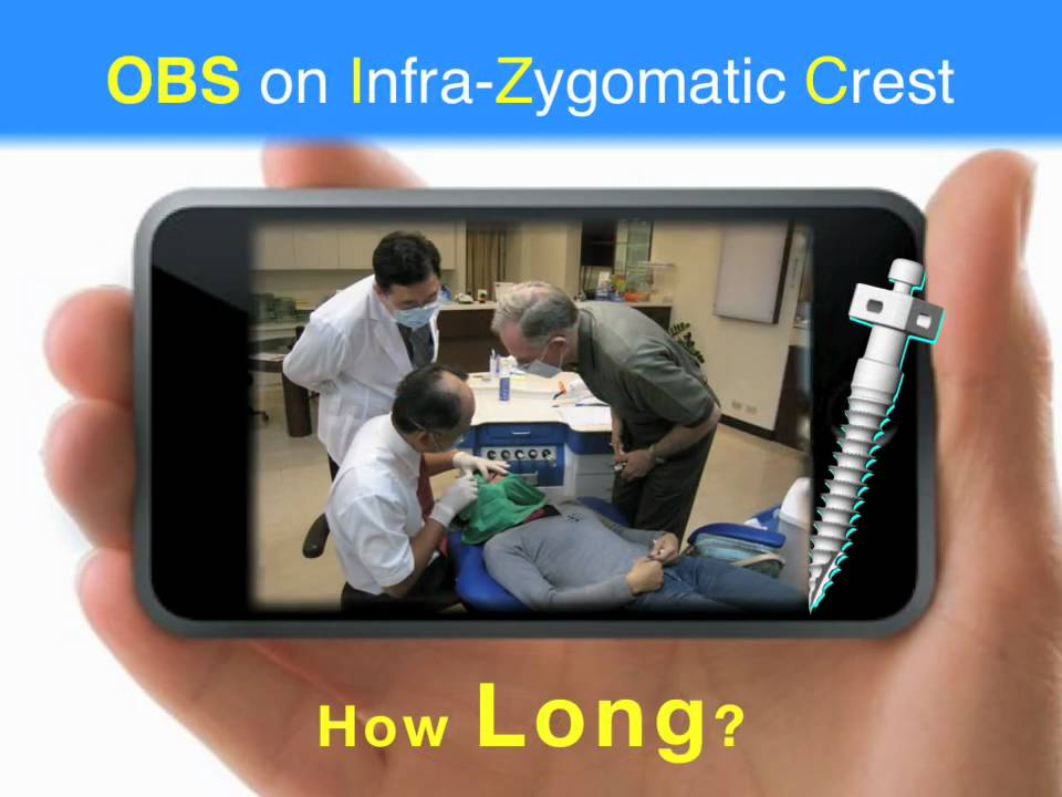 OBS-6. 3D Lever Arm - YouTube