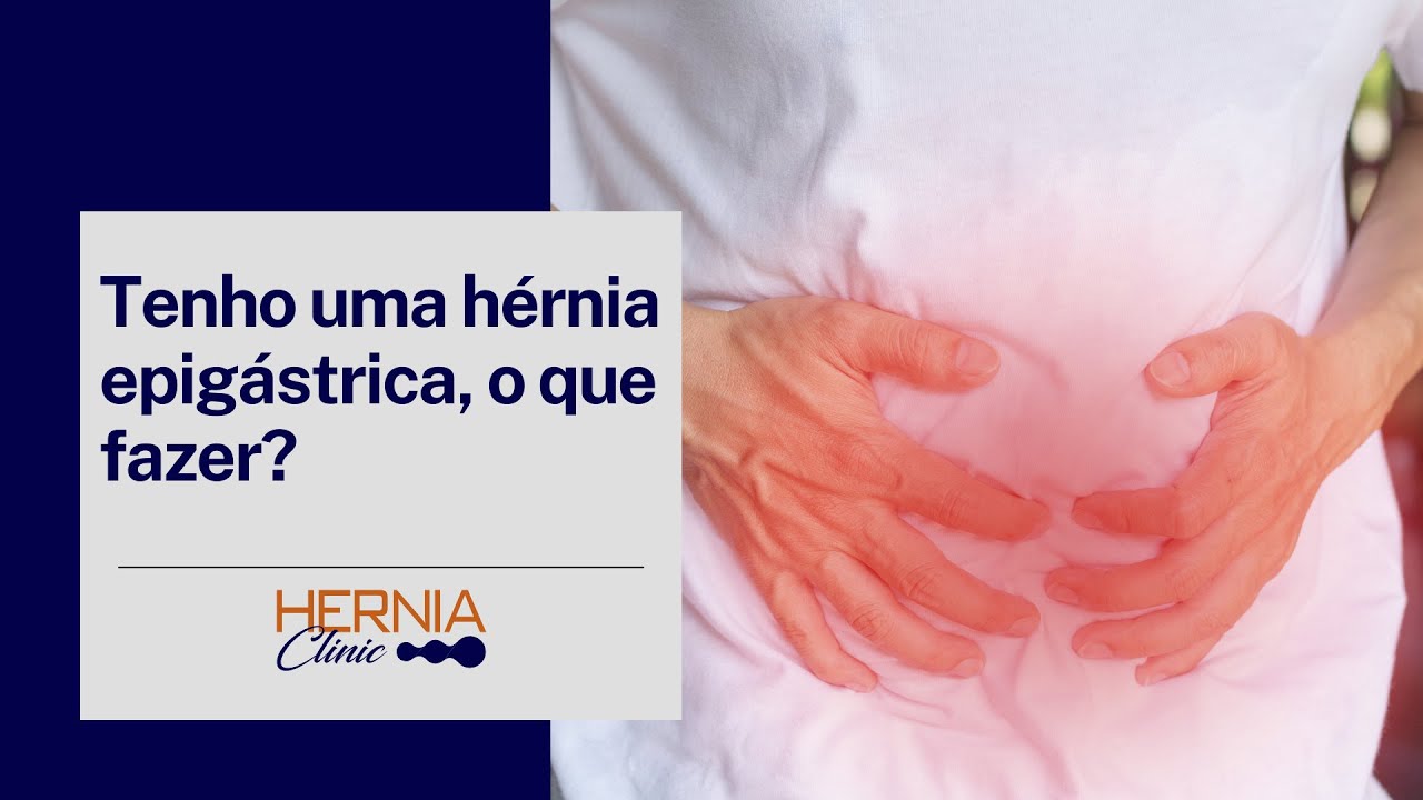 Tenho uma hérnia epigástrica, o que fazer? | Dr. Paulo Barros CRM: 141104 - YouTube