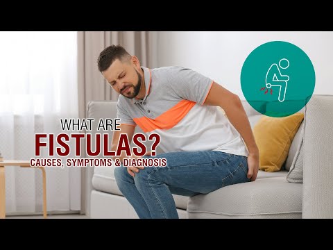 What Are Fistulas? Causes, Symptoms & Diagnosis | Dr. P. Siva Charan Reddy