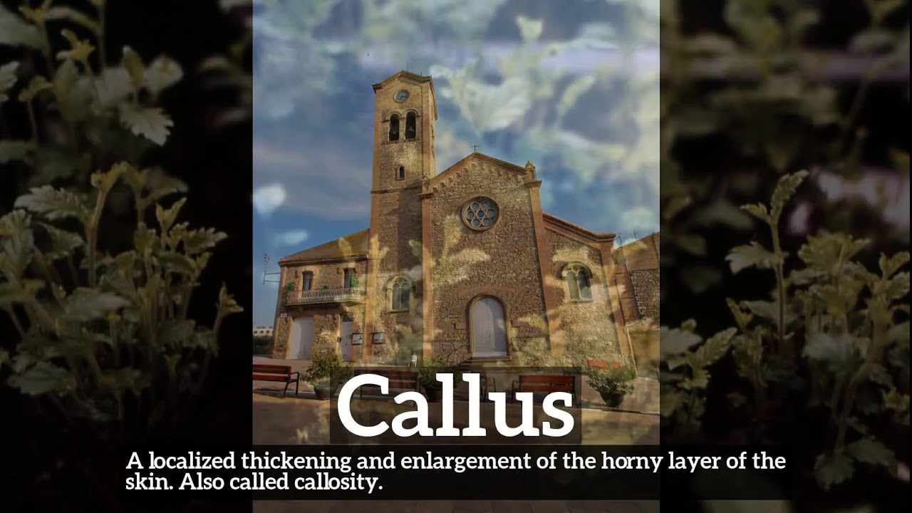 How Does Callus Look? | How to Say Callus in English? | What is Callus ...