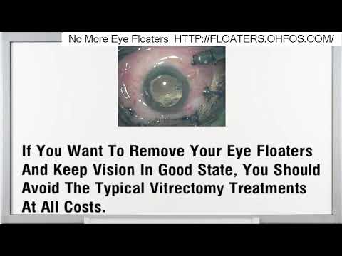 Black Spot In Vision One Eye - YouTube
