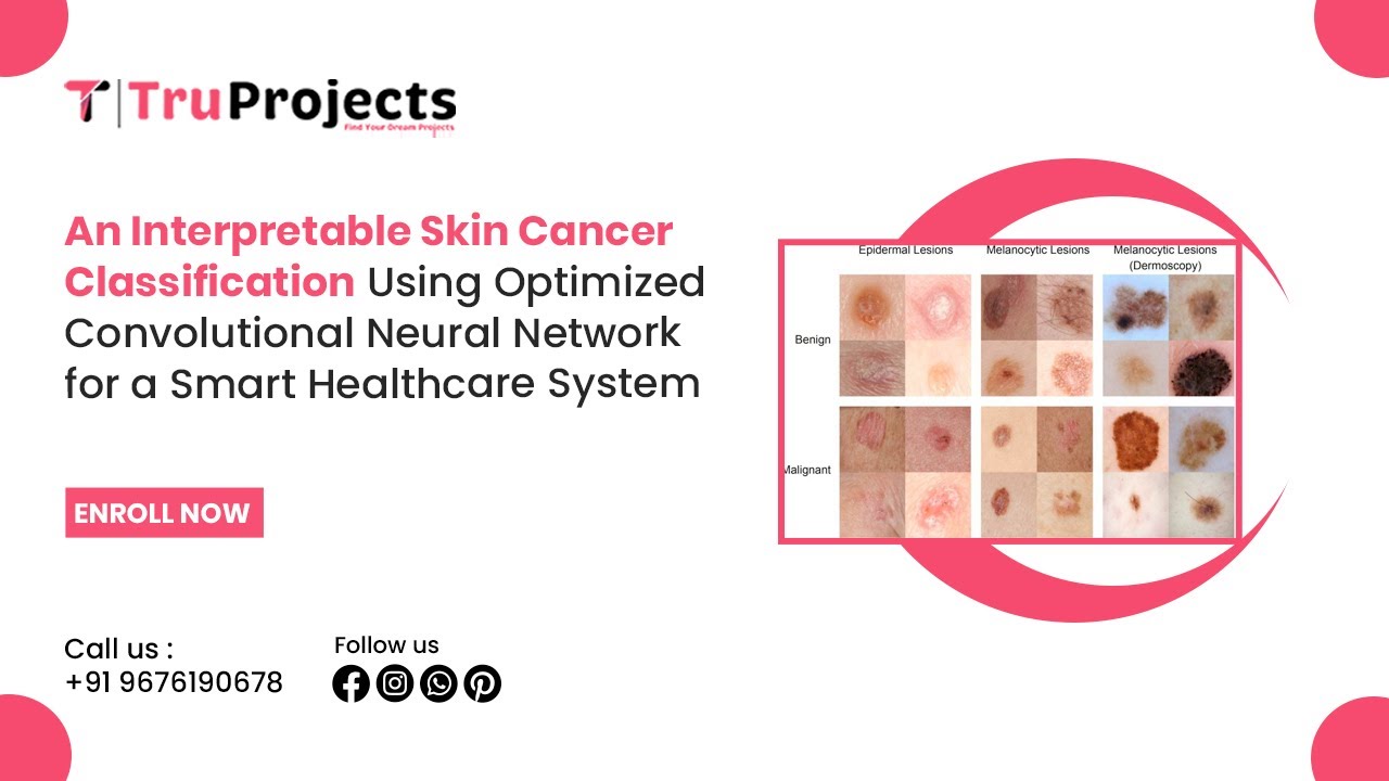 An Interpretable Skin Cancer Classification Using Optimized ...