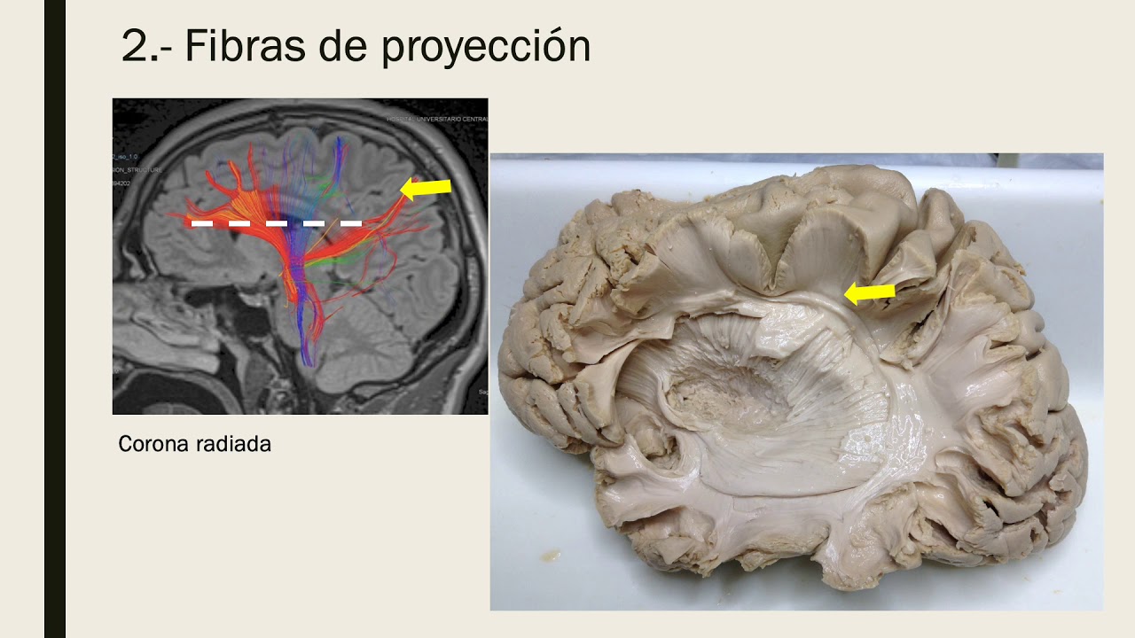 Anatomía del SNC: configuración interna - YouTube