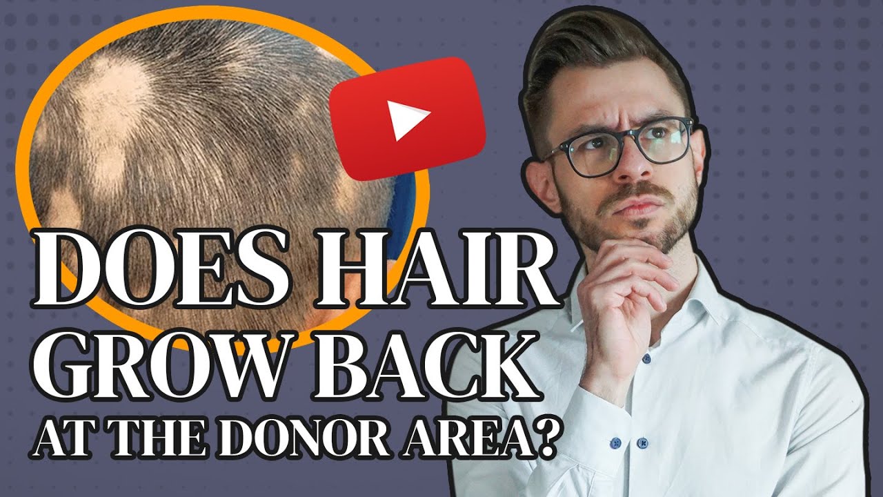 Donor Area Hair Regrowth After Hair Transplant: Fact or Fiction? - YouTube