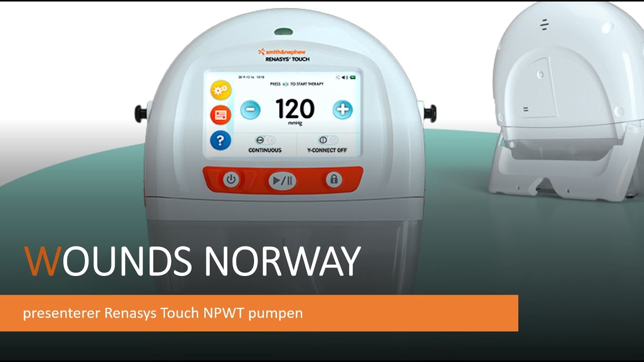 Renasys Touch Wounds Norway - YouTube