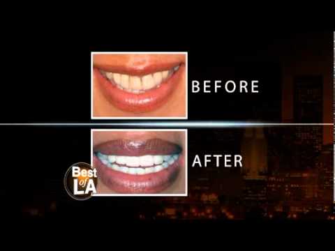 Dr. Mahnaz Rashti DDS - Cosmetic Dentist in Beverly Hills - YouTube
