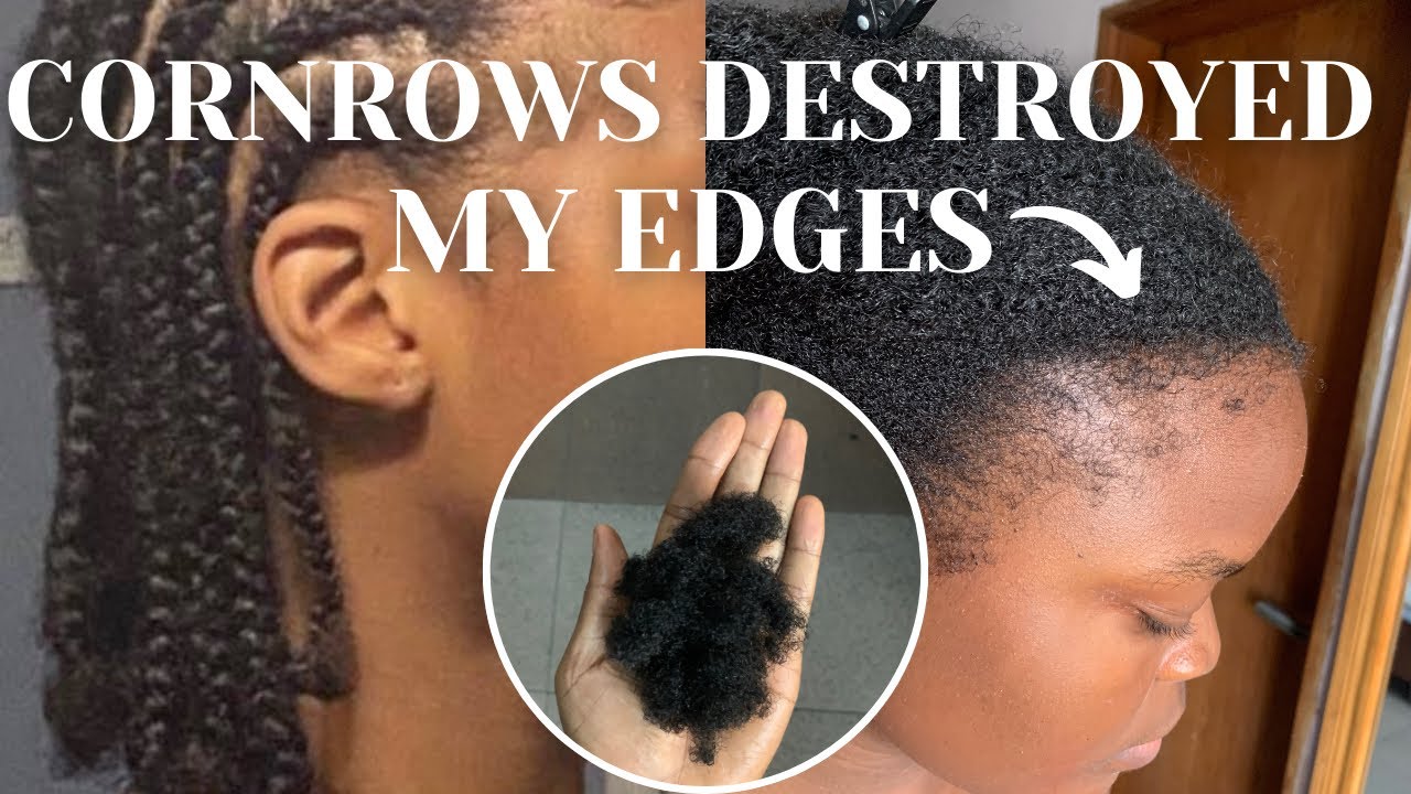 DON’T MAKE CORNROWS IF YOU HAVE FINE HAIR STRANDS!! | 1 month takedown ...