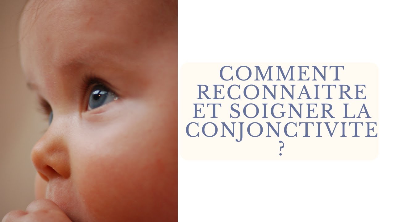 Comment reconnaitre et soigner la conjonctivite? - YouTube