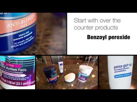 Adult Acne - Mayo Clinic