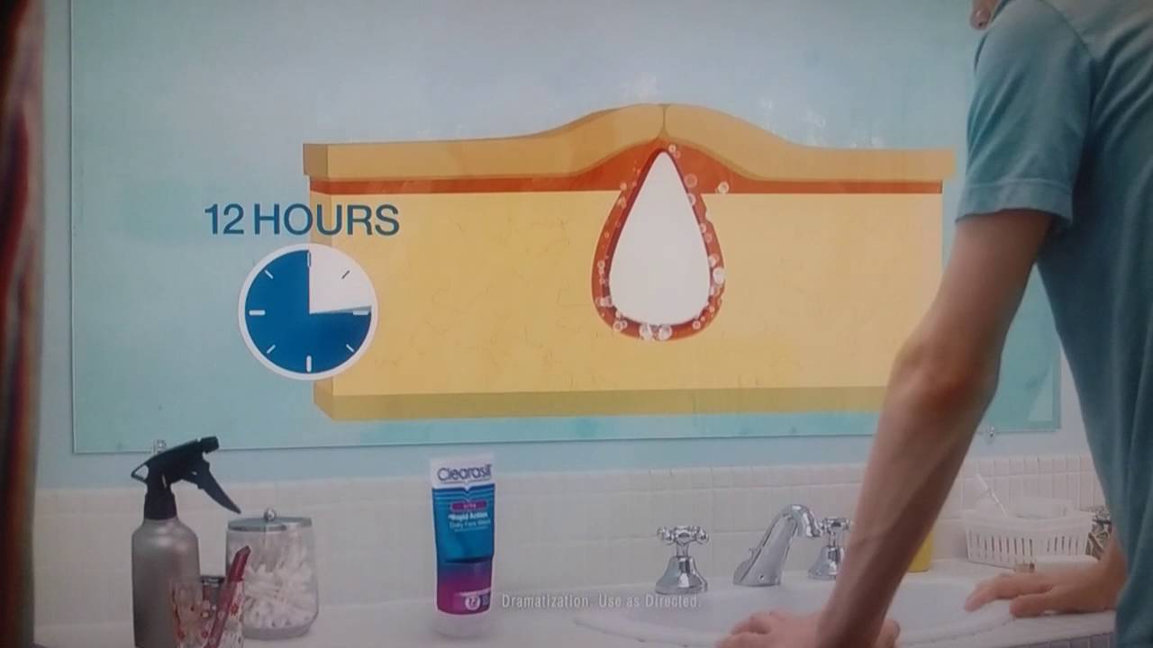 Clearasil Ultra Commercial - YouTube