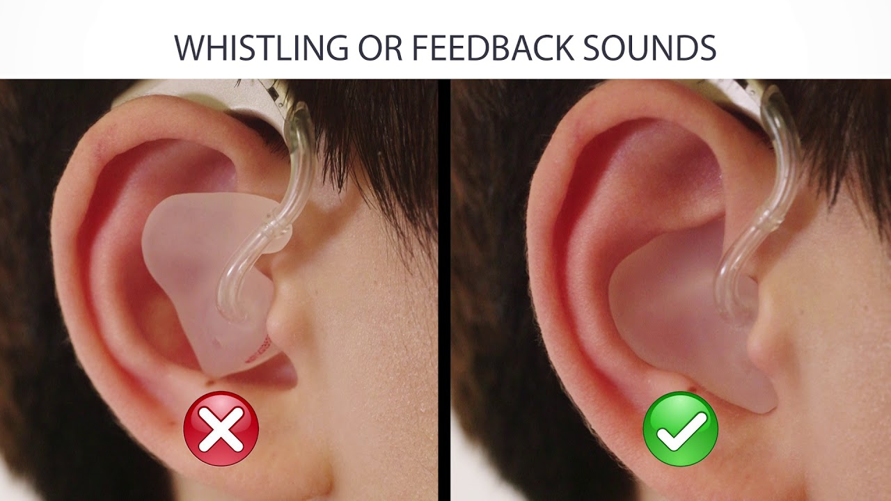 Video 8 - Simple Troubleshooting of Behind-The-Ear (BTE) Hearing Aids - YouTube