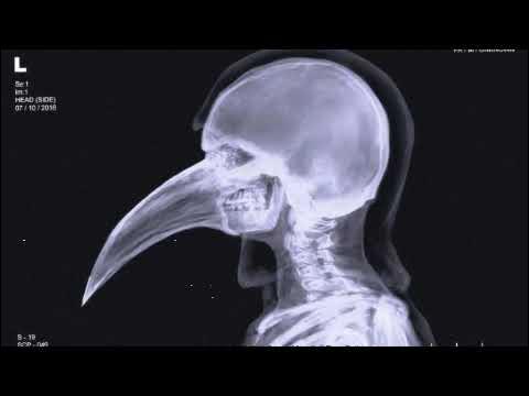 SCP-049 " THE PLAGUE DOCTOR" EAS ANALOG HORROR - YouTube