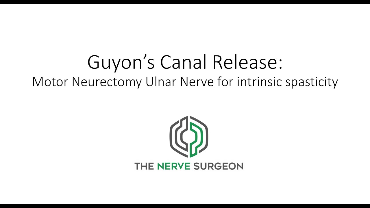 Motor Neurectomy Ulnar nerve keynote - YouTube