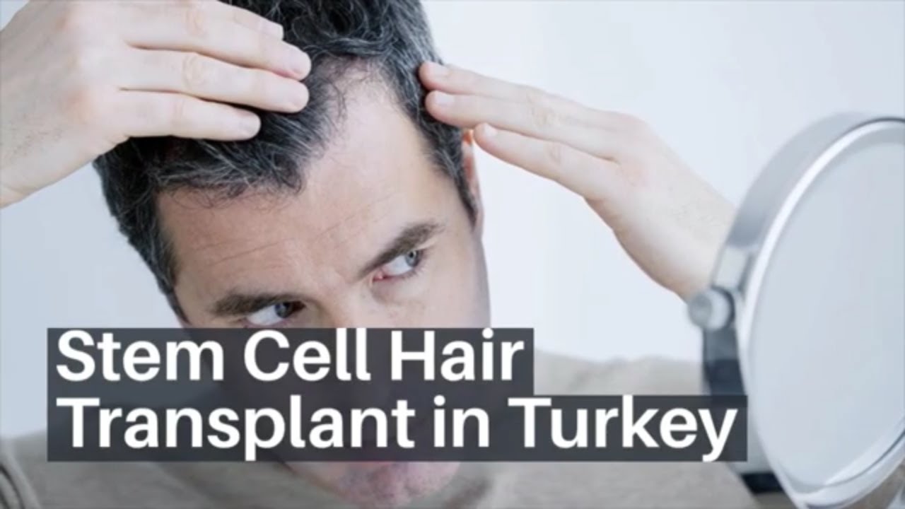 What Is Stem Cell Hair Transplant Stem Cell Hair Transplant In Turkey