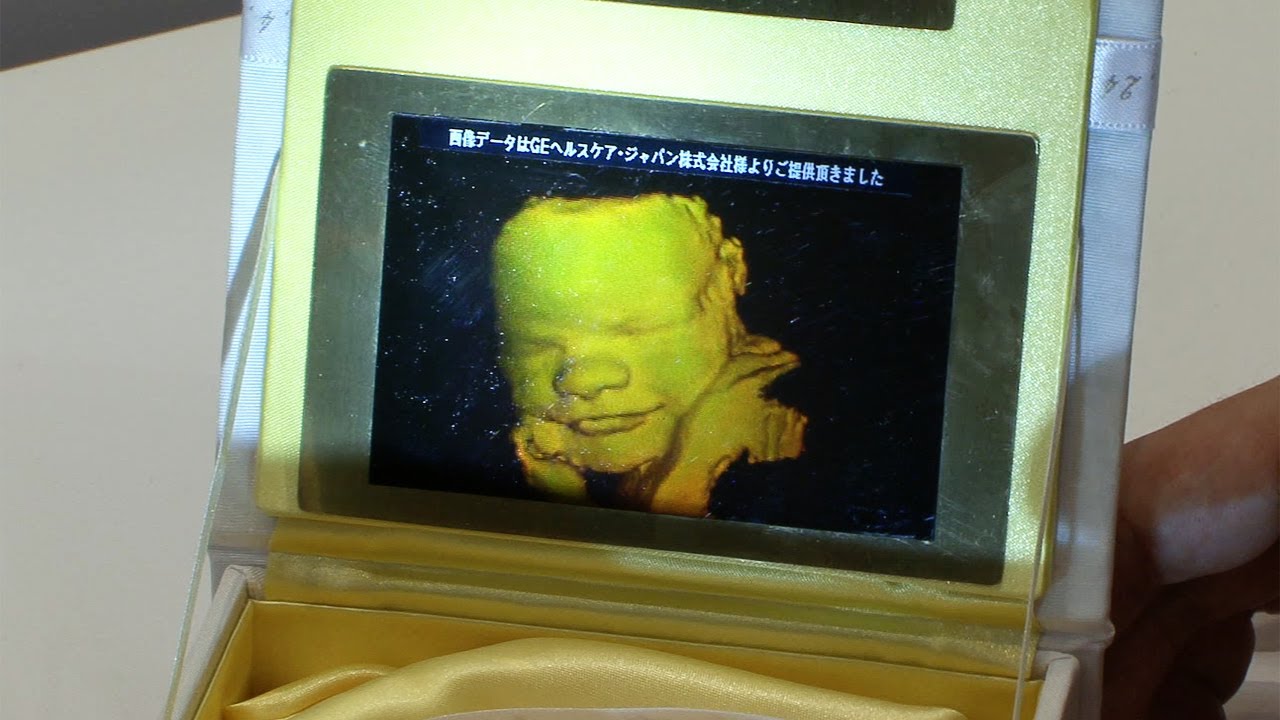 3D/4D ultrasound hologram printing service using Pioneer's compact ...