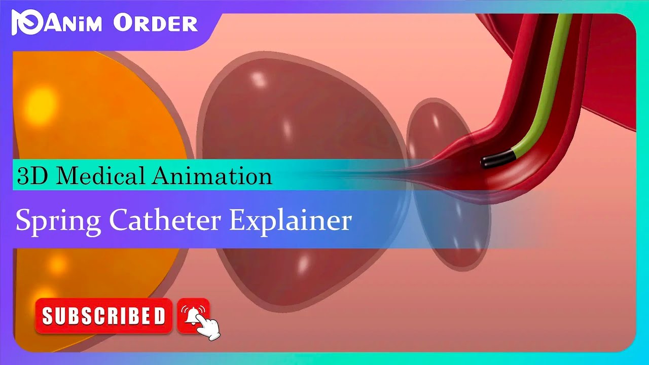 Introducing Spring Catheter | 3D medical animation by Animorder.com ...