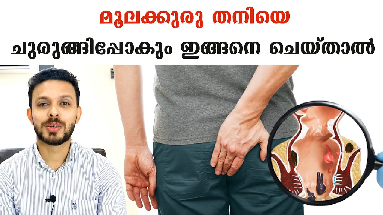 മൂലക്കുരു തനിയെ ചുരുങ്ങിപ്പോകും ഇങ്ങനെ ചെയ്താൽ /Dr Fasil mohammed - YouTube