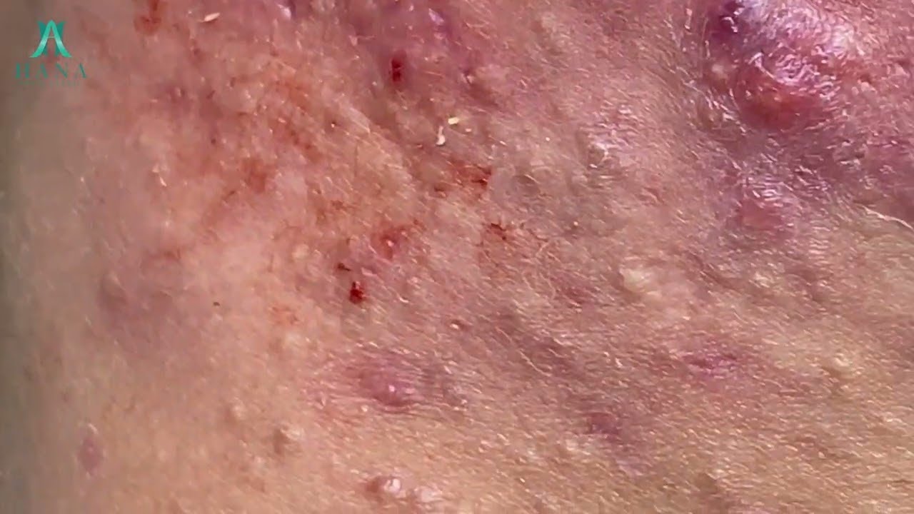 Satisfying Relaxation With Hana Spa #9 - YouTube